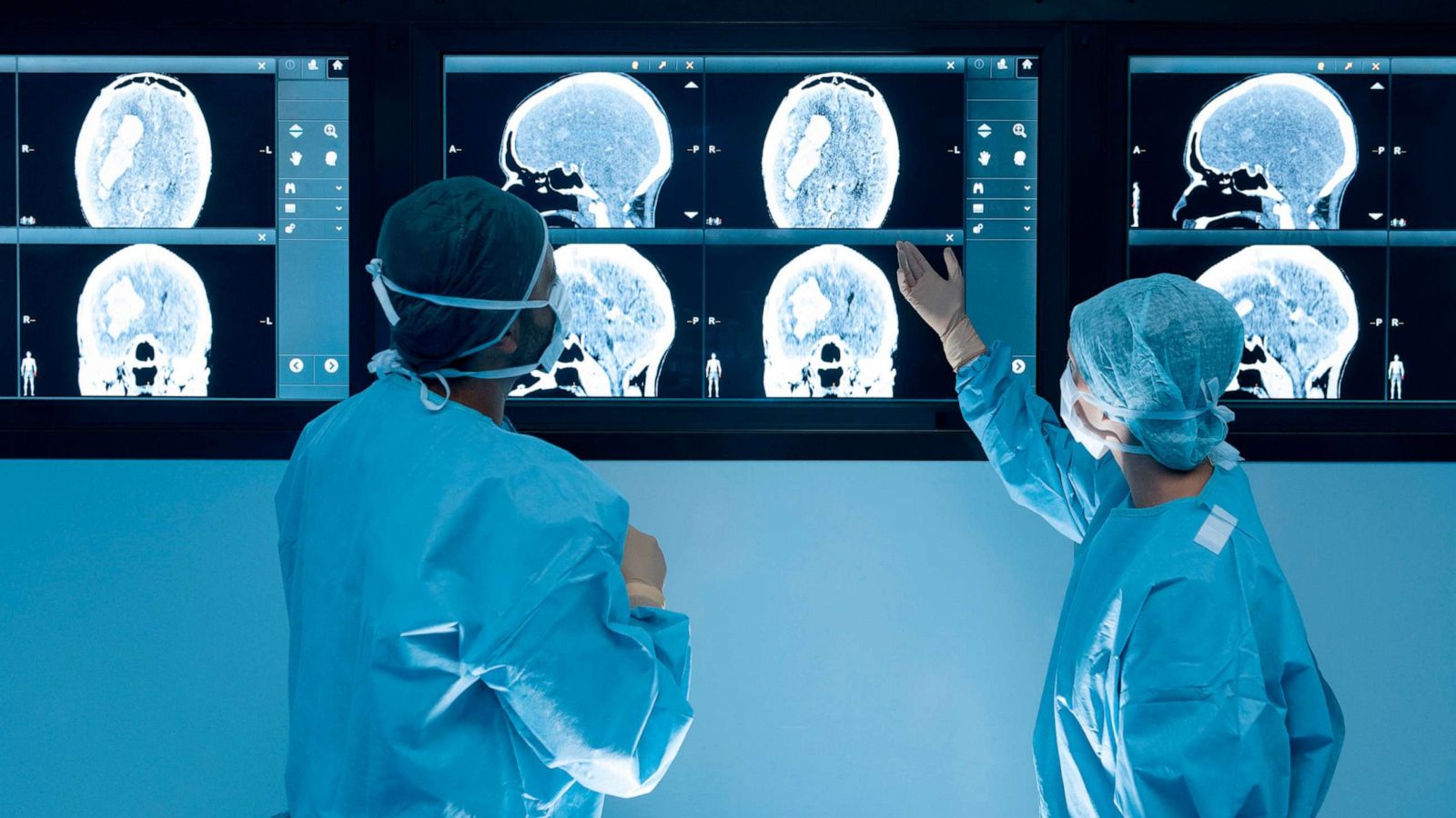 Brain Injuries - Mark Wolin Personal Injury Attorney